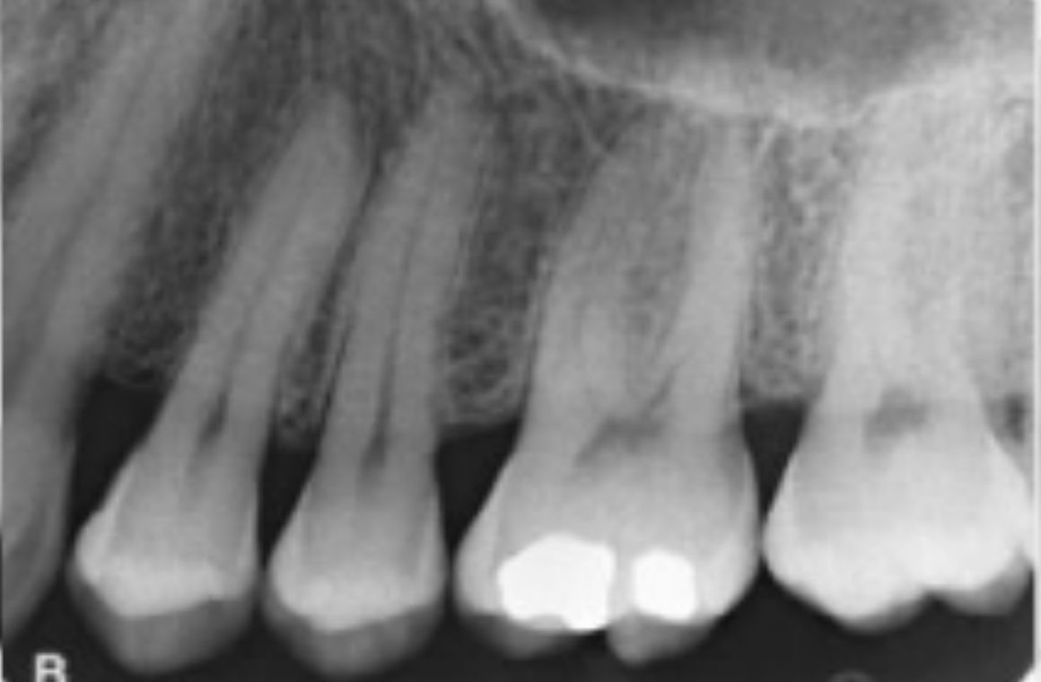 Rontgen Gigi Klinik Terdekat & Terbaik di Jakarta