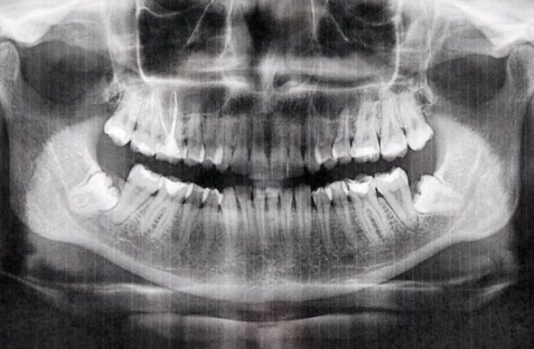 Rontgen Gigi Klinik Terdekat & Terbaik di Jakarta