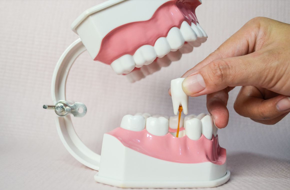 Harga Cabut Gigi Berlubang - Klinik Cabut Gigi Terdekat Terbaik