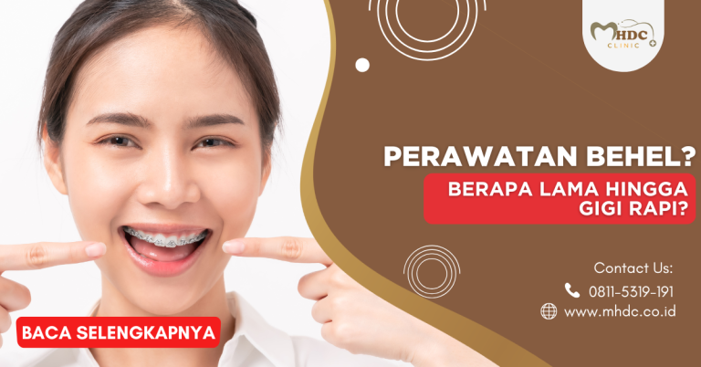 Perawatan Behel: Berapa Lama Hingga Gigi Rapi?