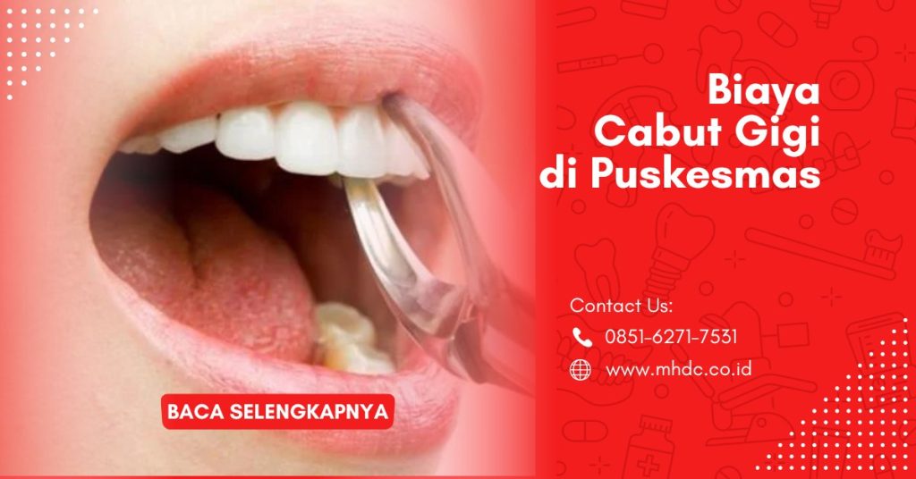 Gigi Bungsu : Pengertian, Gejala dan Cara Mengatasinya!