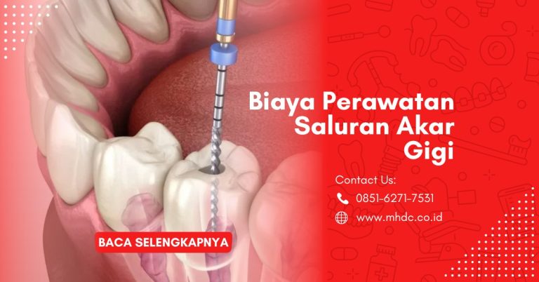 Estimasi Biaya Perawatan Saluran Akar Gigi Lengkap