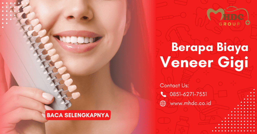 Ini Harga Biaya Veneer Gigi dan Pentingnya Veneer Gigi