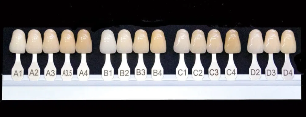 Seberapa Cerah Memutihkan Gigi dengan Bleaching