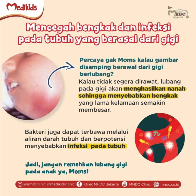 Gigi Susu Anak Berlubang, Harus Ditambal atau Tunggu Ganti?
