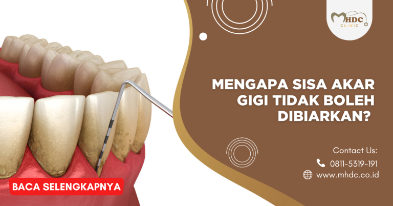 Mengapa Sisa Akar Gigi Tidak Boleh Dibiarkan?