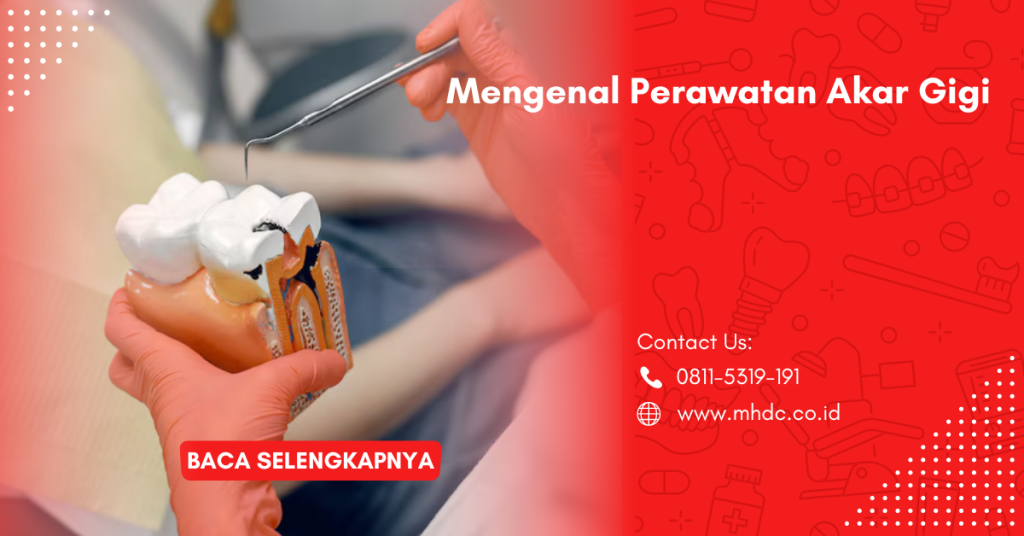 Perawatan Akar Gigi