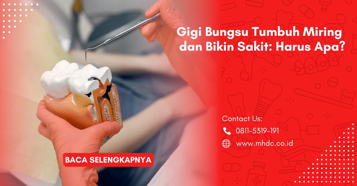 Gusi Bengkak pada Anak: Penyebab, Gejala, Cara Pencegahannya