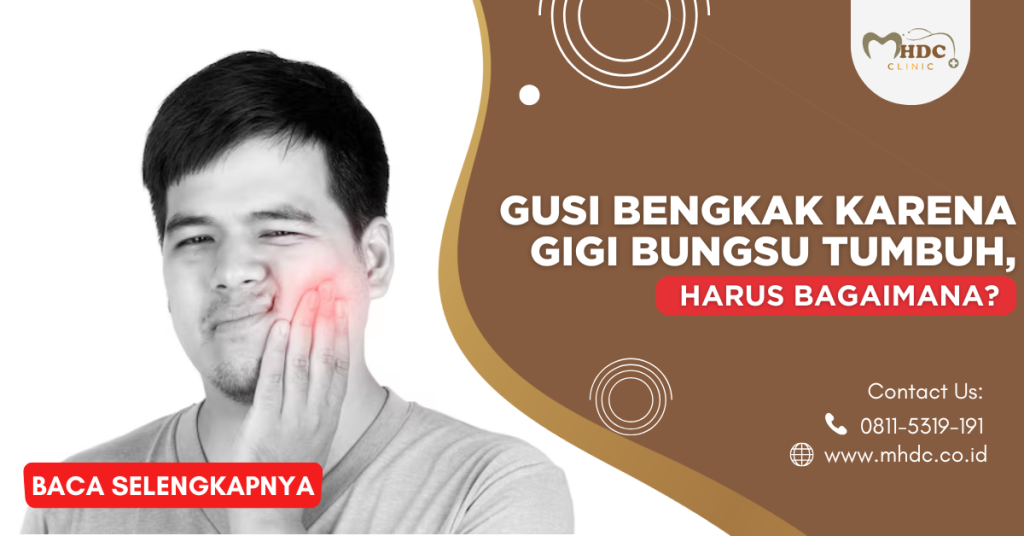 Gusi Bengkak karena Gigi Bungsu Tumbuh, Harus Bagaimana?