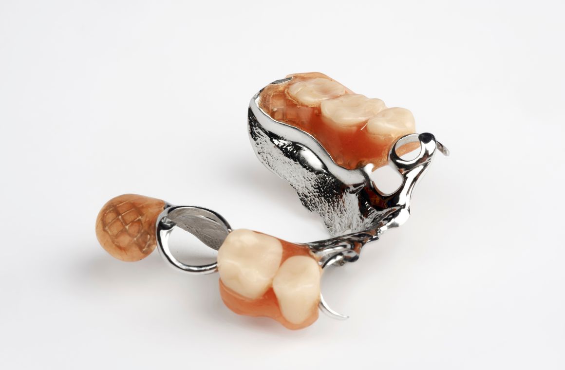 Gigi Palsu Lepasan – Klinik Dokter Gigi Terdekat