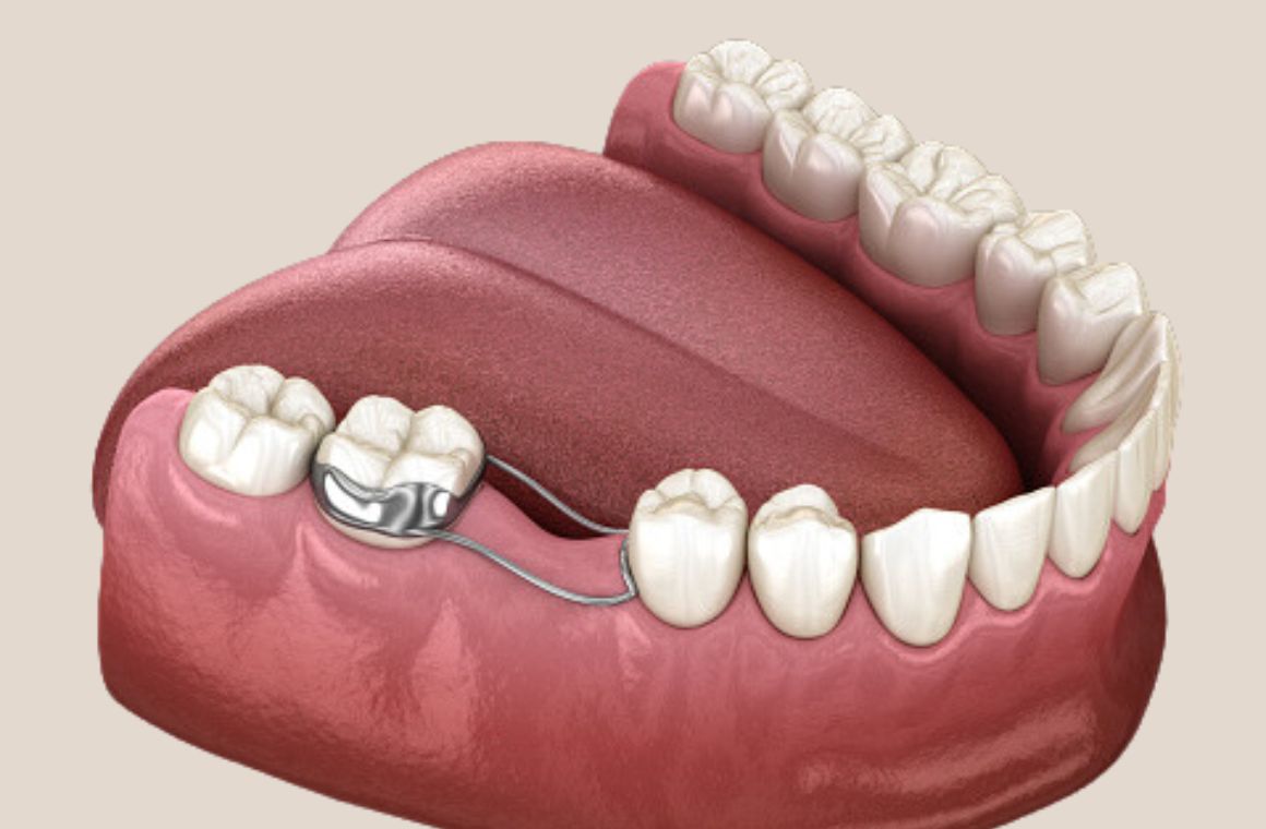 Cara Mencabut Gigi Anak dengan Aman MHDC - Dental Clinic