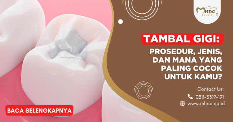 Tambal Gigi: Prosedur, Jenis, dan Mana yang Cocok untuk Kamu?