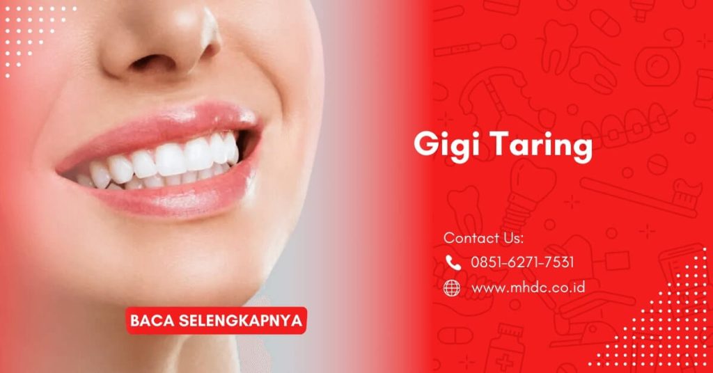 Apa Itu Gigi Taring? Fungsi dan Cara Merawatnya!