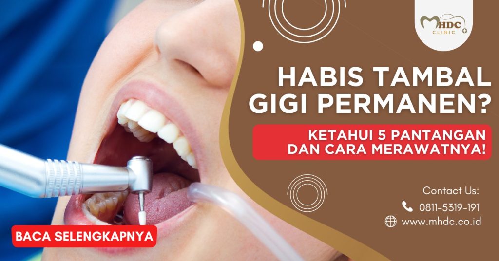 Habis Tambal Gigi Permanen? Ketahui 5 Pantangan dan Cara Merawatnya!