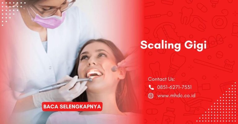 Ini Estimasi Harga Scaling Gigi Lengkap Beserta Rinciannya!