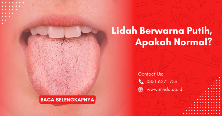 Lidah Berwarna Putih, Apakah Normal?
