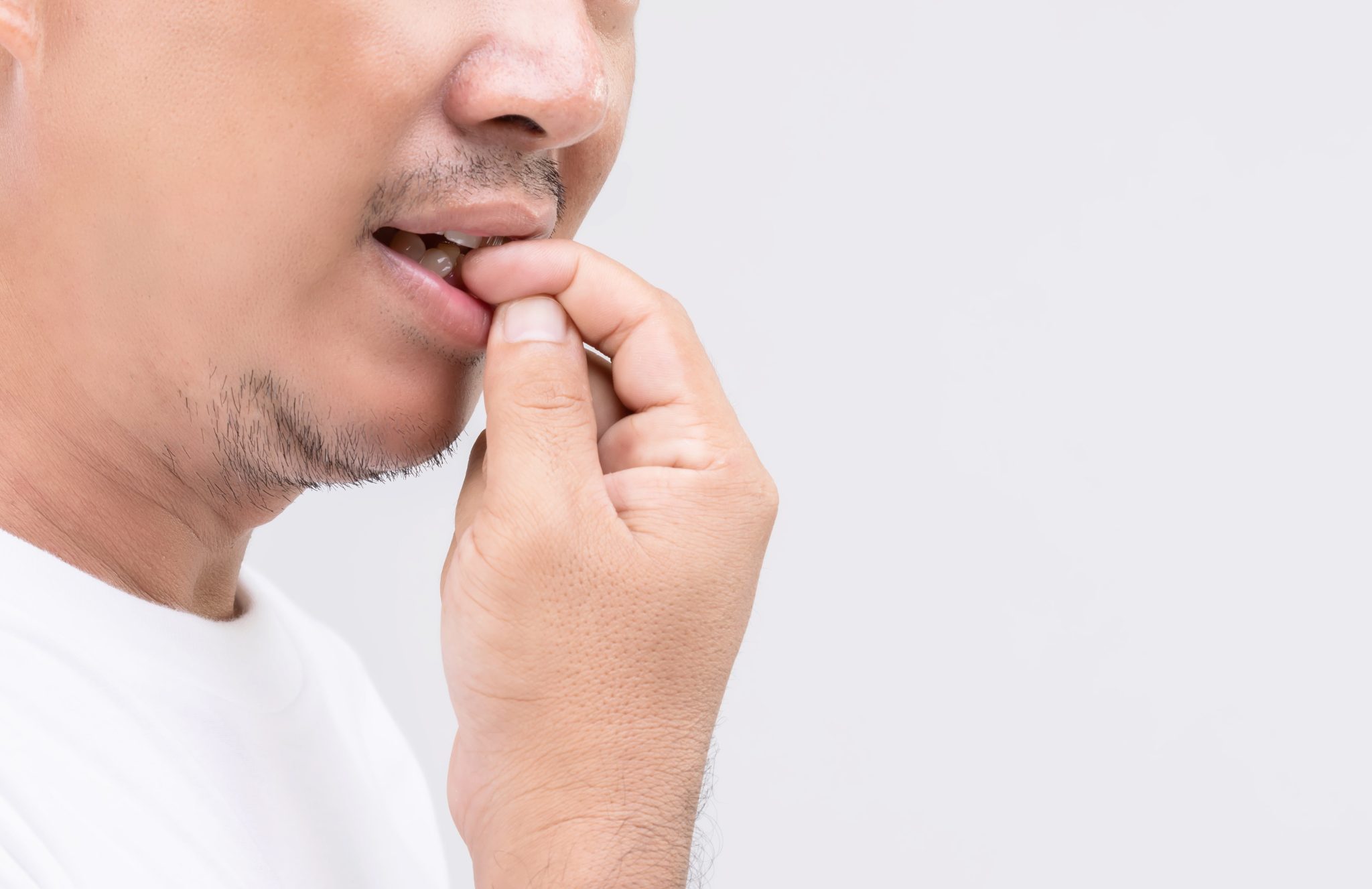 Habis Tambal Gigi Permanen? Ketahui 5 Pantangan dan Cara Merawatnya!