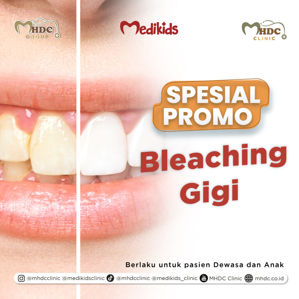 Penyebab dan Cara Mengatasi Sakit Gigi pada Anak yang Efektif