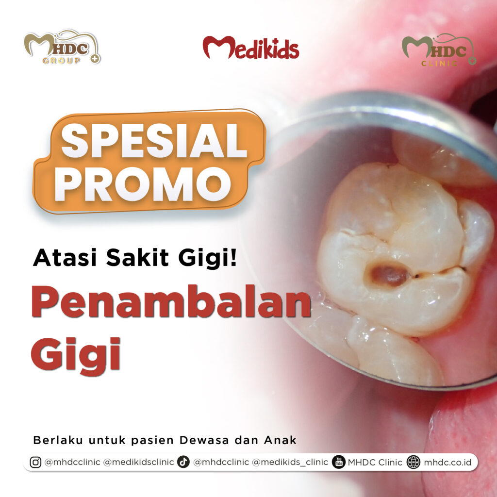 Sebelum Pasang Gigi Palsu, Ini yang Harus Kamu Tahu - Klinik Dokter Gigi Terdekat